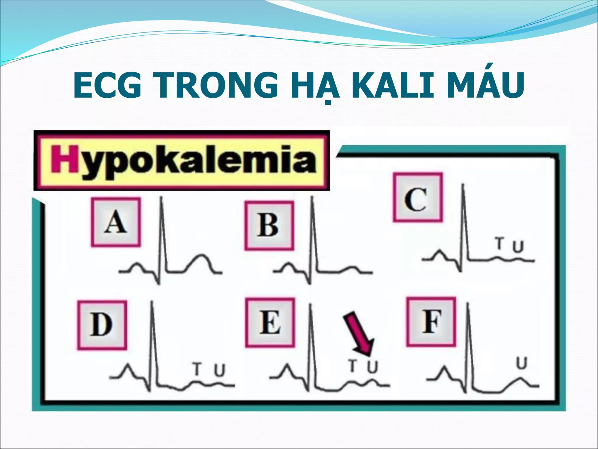 Rối Loan Kali máu- ThS_BS_ Tu.pdf