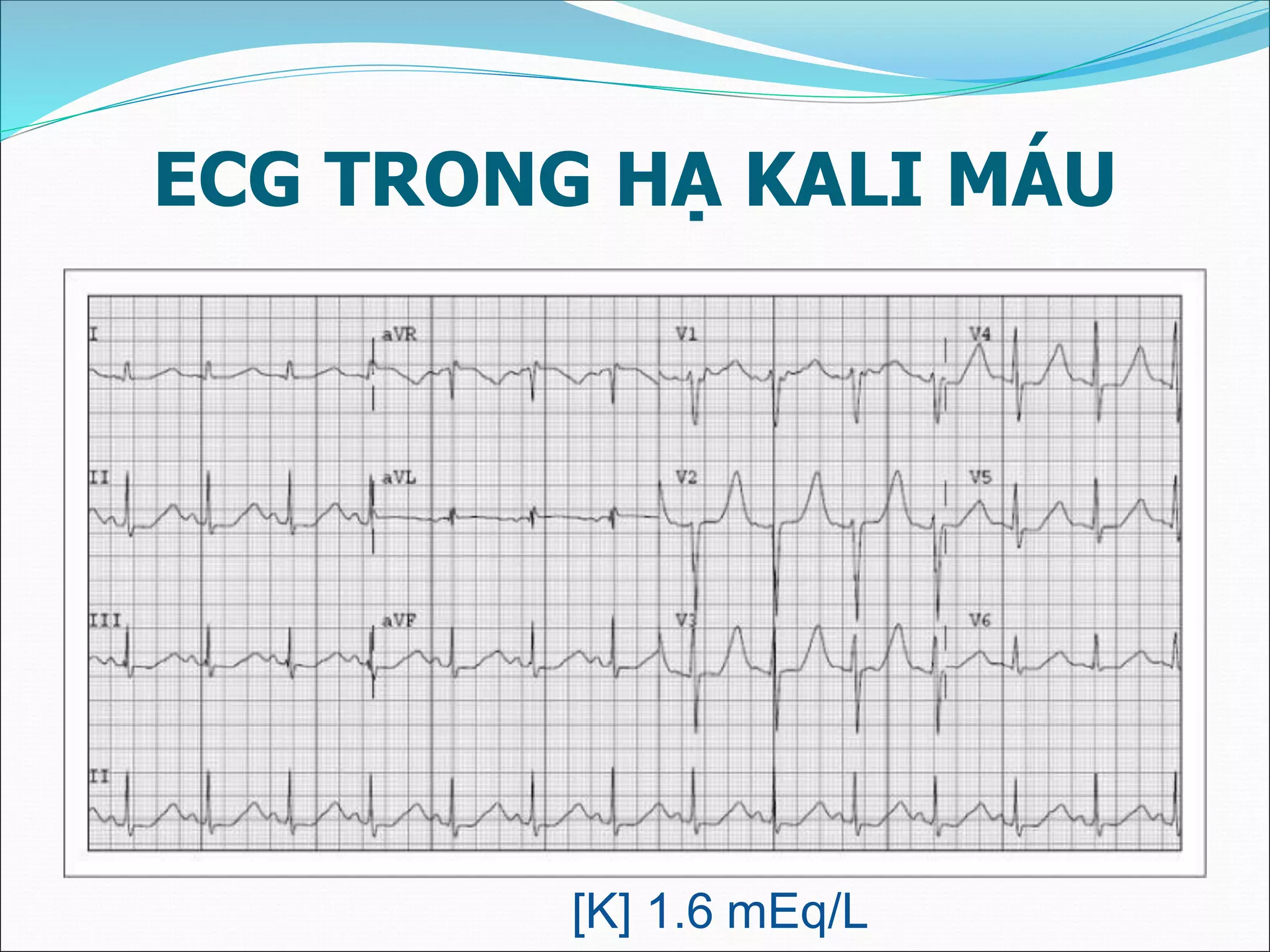 Rối Loan Kali máu- ThS_BS_ Tu.pdf