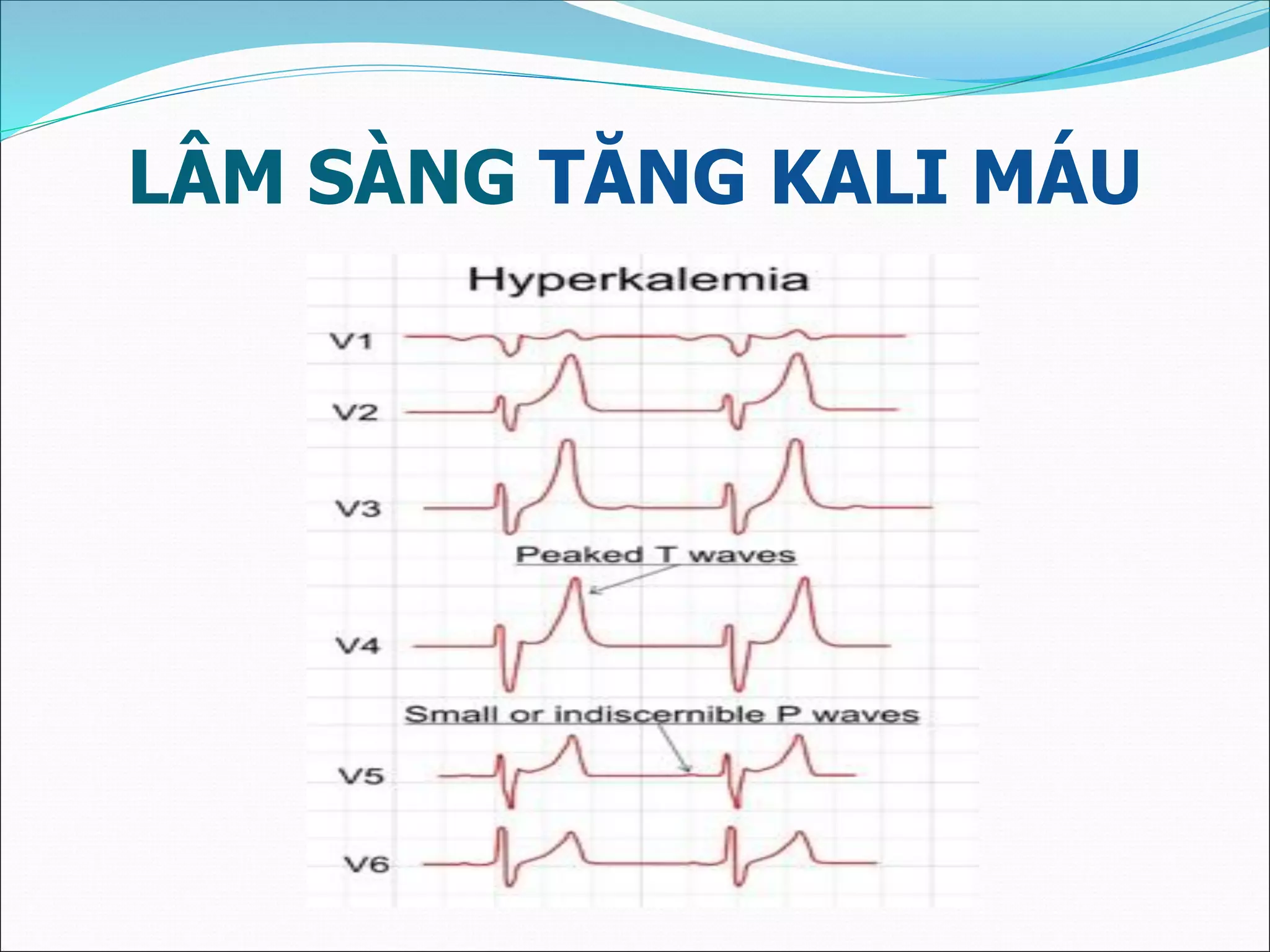 Rối Loan Kali máu- ThS_BS_ Tu.pdf
