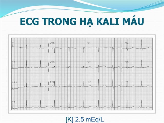 Rối Loan Kali máu- ThS_BS_ Tu.pdf