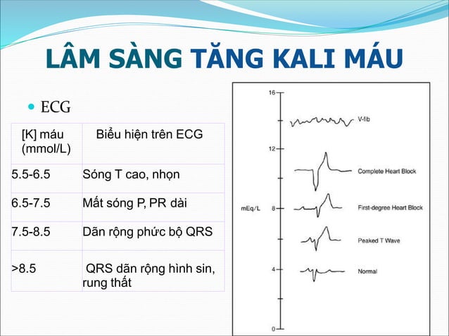 Rối Loan Kali máu- ThS_BS_ Tu.pdf
