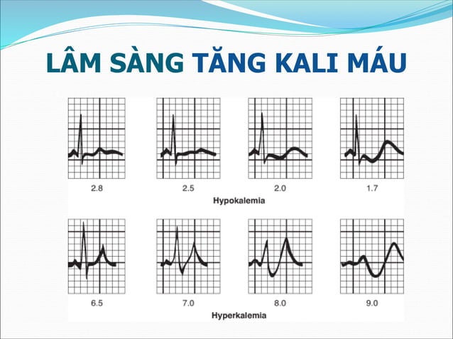 Rối Loan Kali máu- ThS_BS_ Tu.pdf