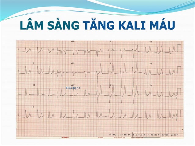 Rối Loan Kali máu- ThS_BS_ Tu.pdf