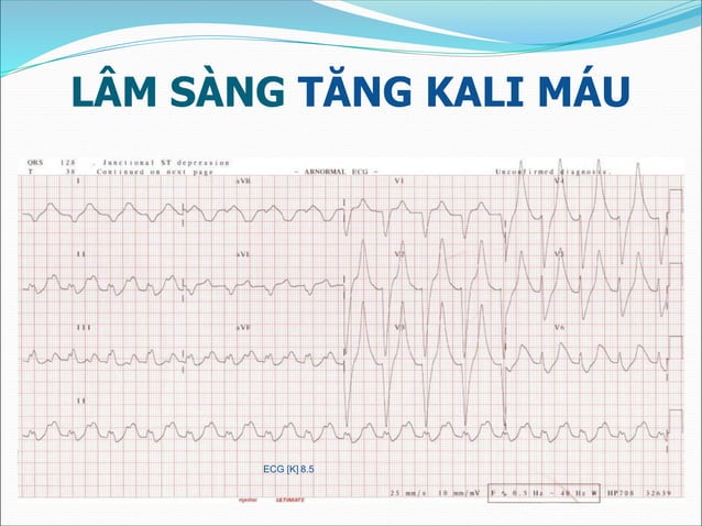 Rối Loan Kali máu- ThS_BS_ Tu.pdf