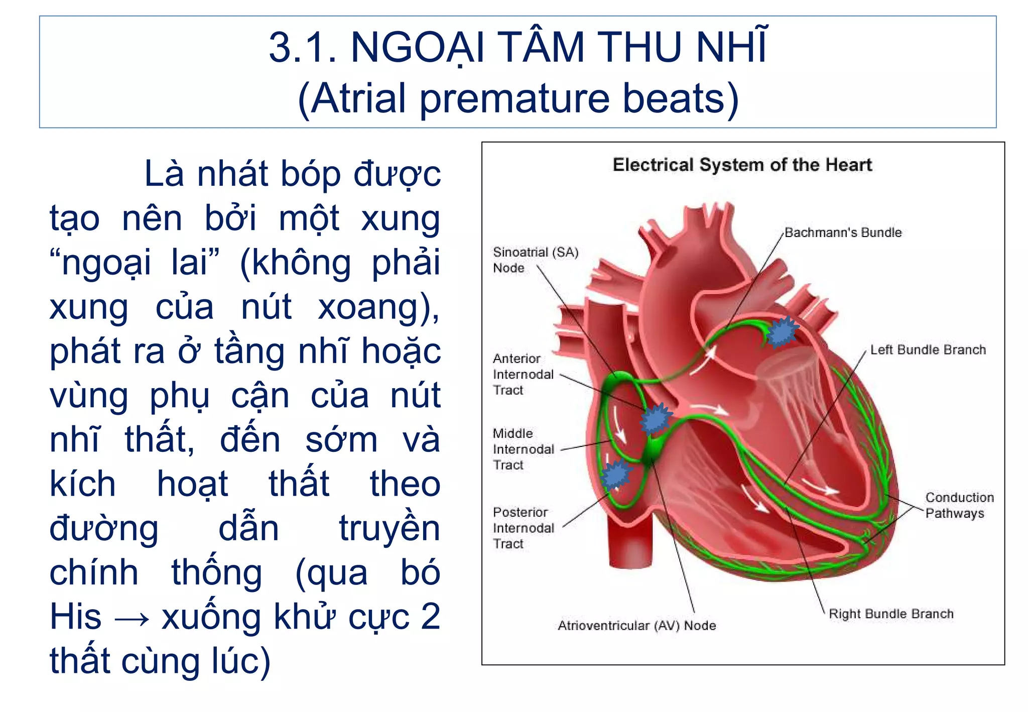 Rối loạn nhịp tim đánh giá qua điện tâm đồ | PDF