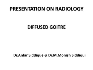 DIFFUSED GOITRE | PPT