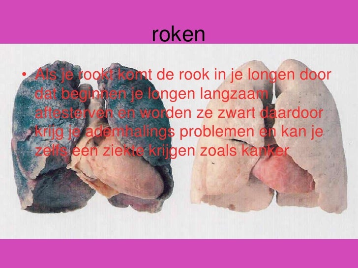 Roken Groep Marjolein