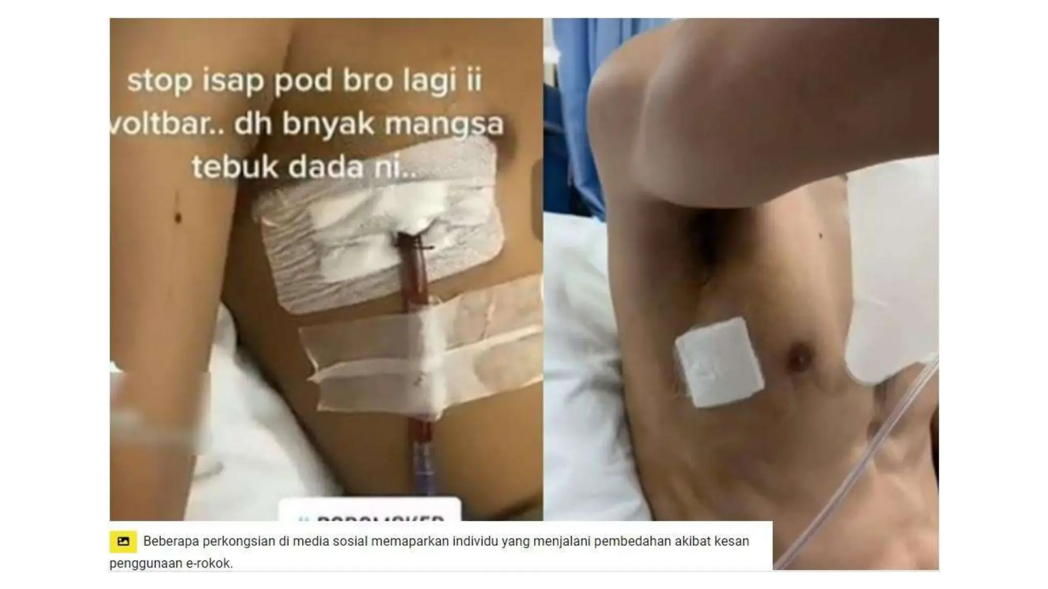 Rokok dan vape | kesan-kesan vape elektronik | PPTX