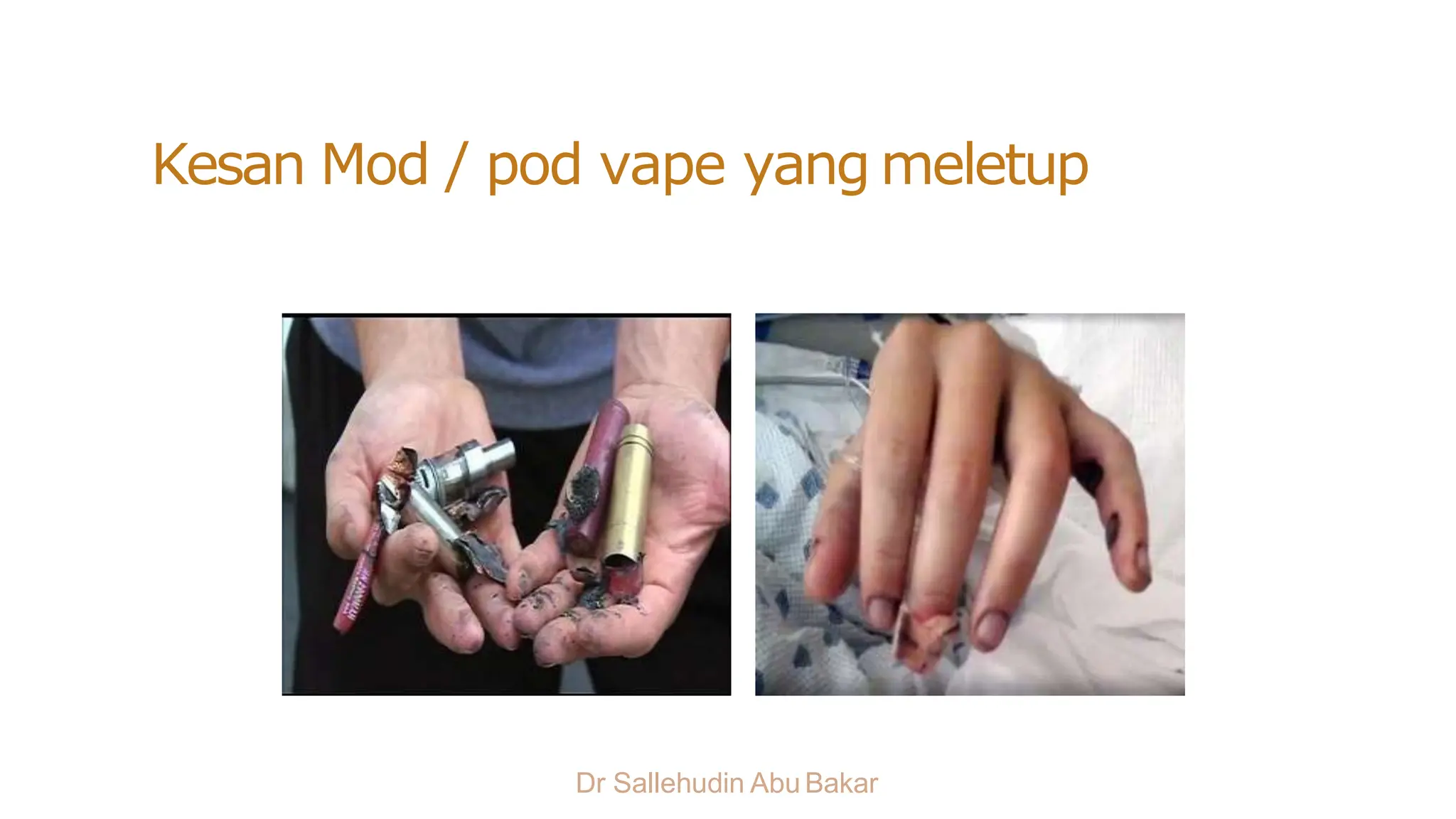 Rokok dan vape | kesan-kesan vape elektronik | PPTX