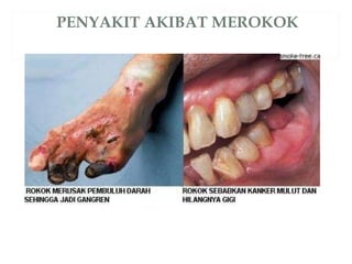 Rokok itu berbahayaa | PPT