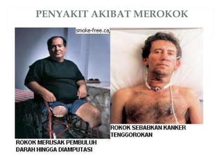 Rokok itu berbahayaa | PPT