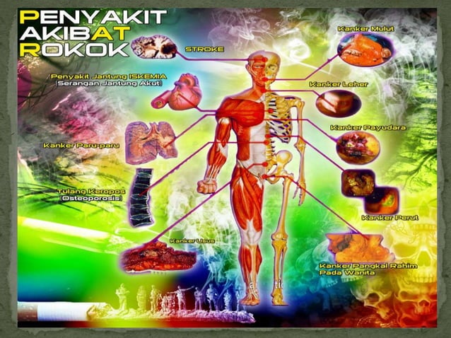 Rokok memperburuk penyakit | PPT
