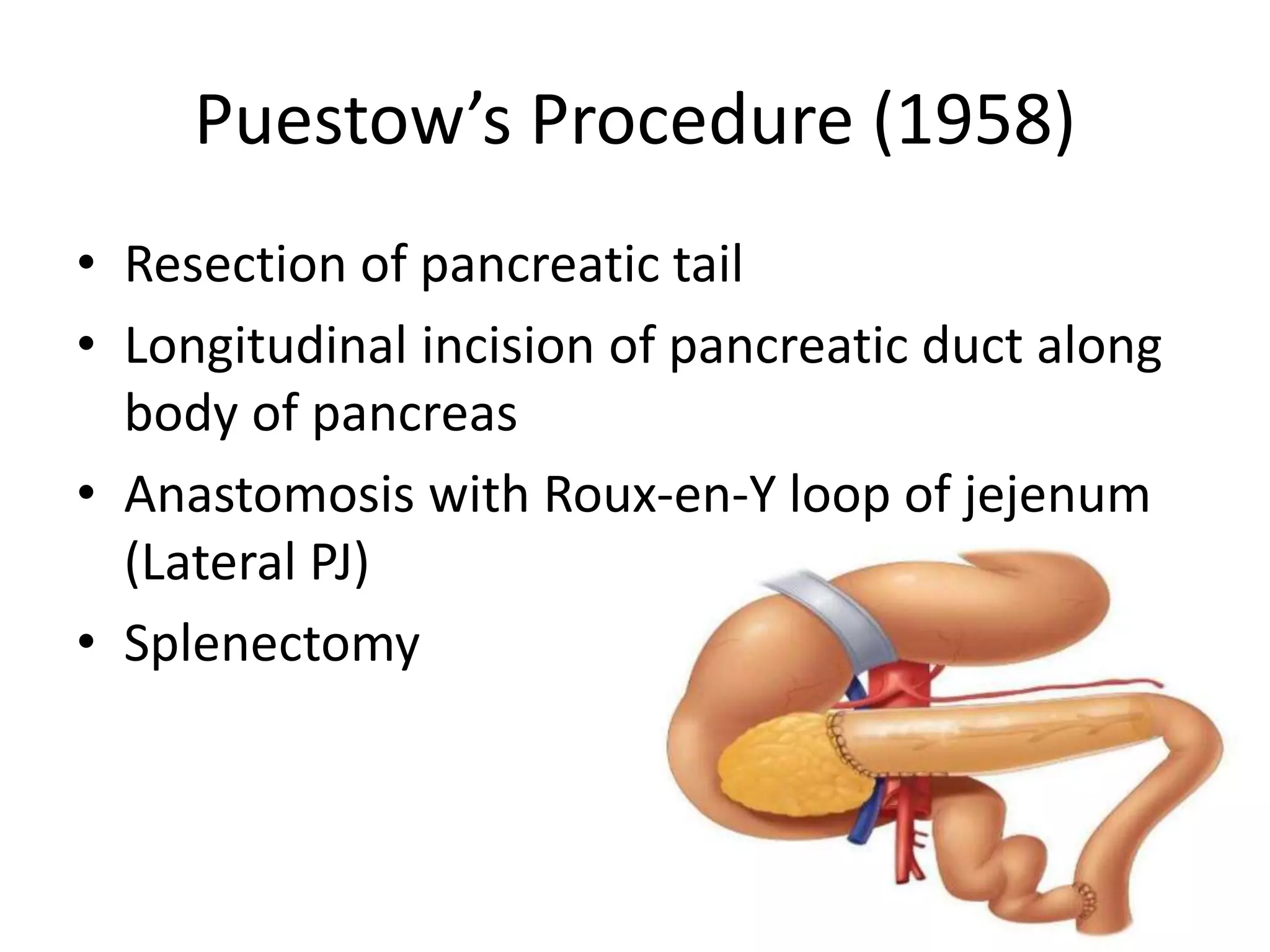Role and types of surgery in chronic pancreatitis | PPTX