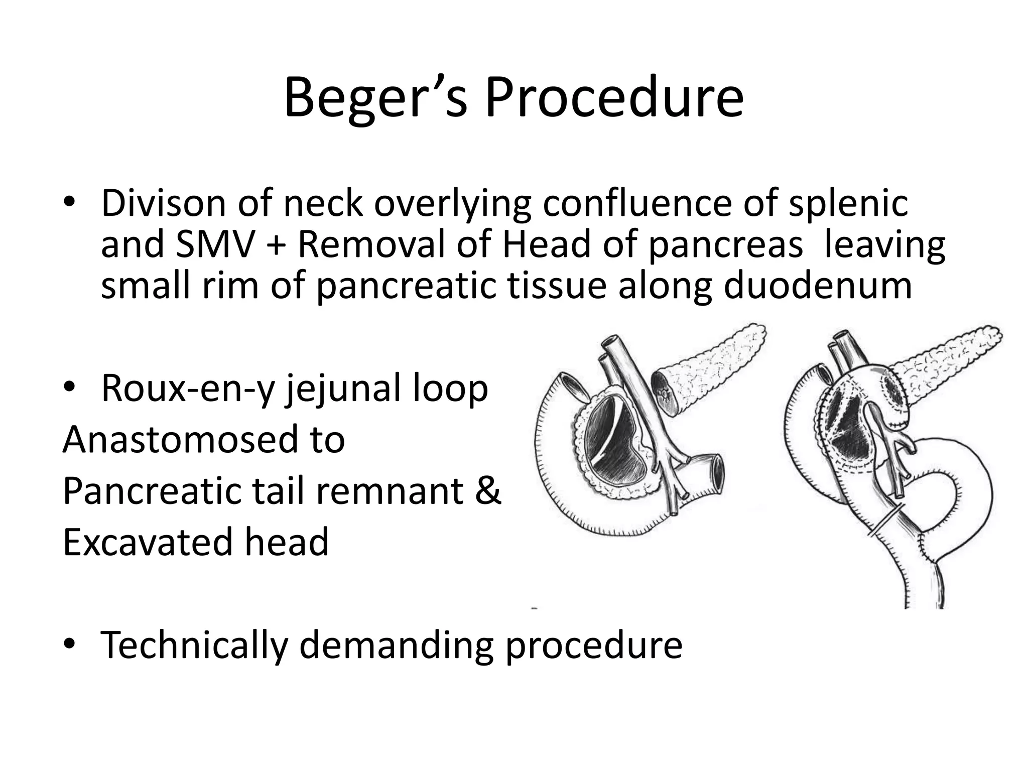 Role and types of surgery in chronic pancreatitis | PPTX