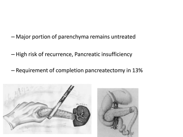 Role and types of surgery in chronic pancreatitis | PPTX | Digestive ...