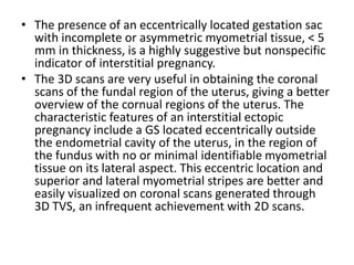 Role of 3 d ultrasound in ectopic pregnancy | PPTX
