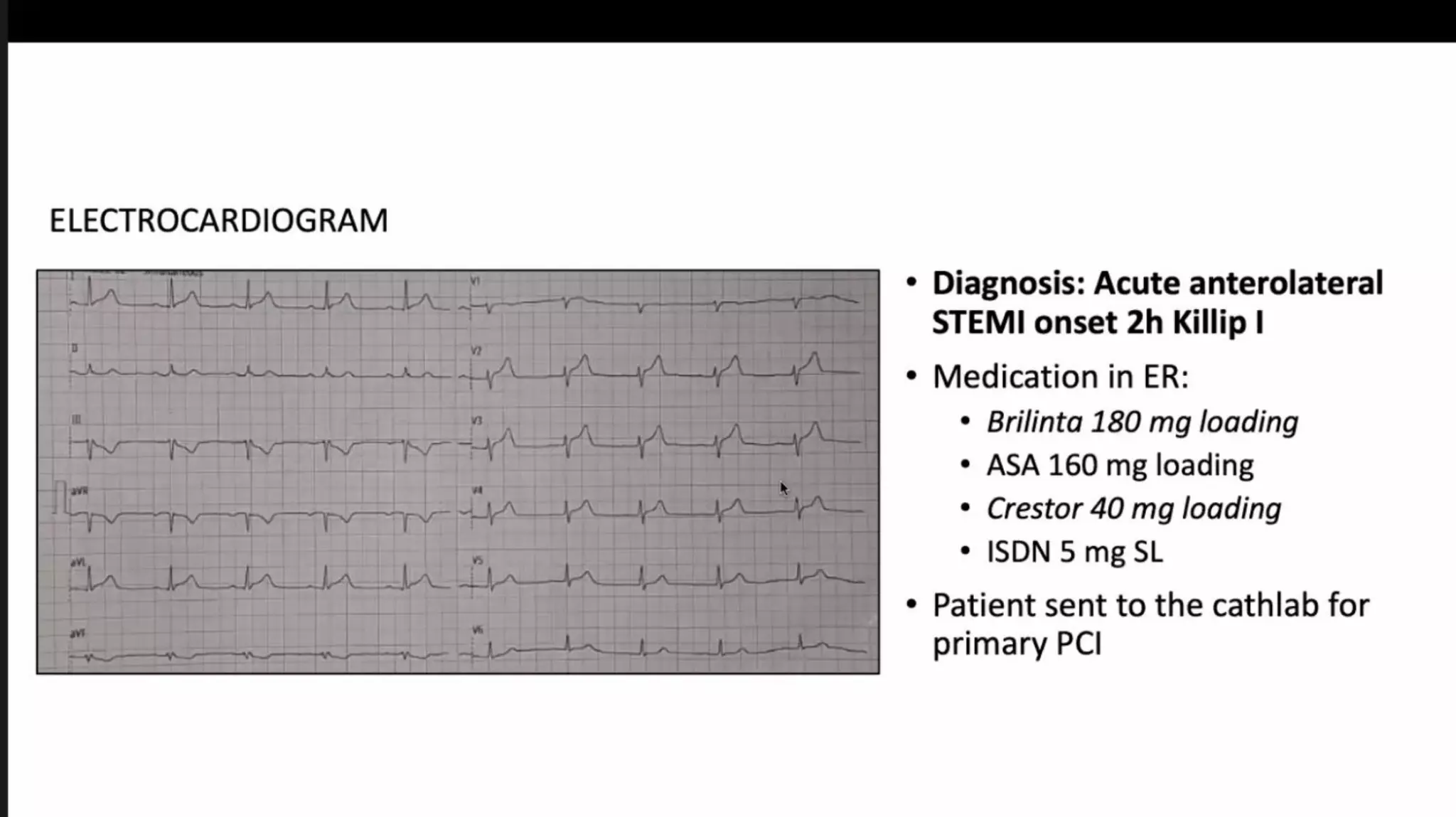 Role of 3rd Generation Water-Soluble Statin in Managing Dyslipidemia in ...