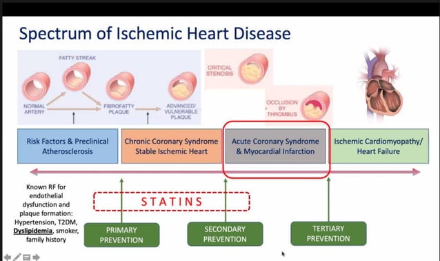 Role of 3rd Generation Water-Soluble Statin in Managing Dyslipidemia in ...