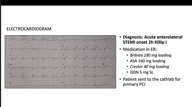 Role of 3rd Generation Water-Soluble Statin in Managing Dyslipidemia in ...