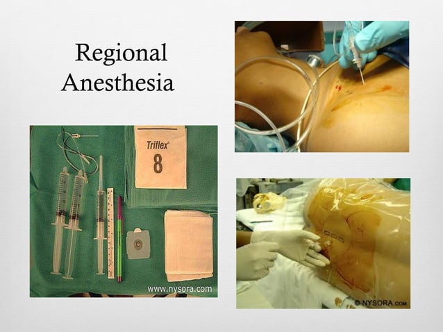 Role of anesthesia nurse in operation theatre | PDF | Lung and ...