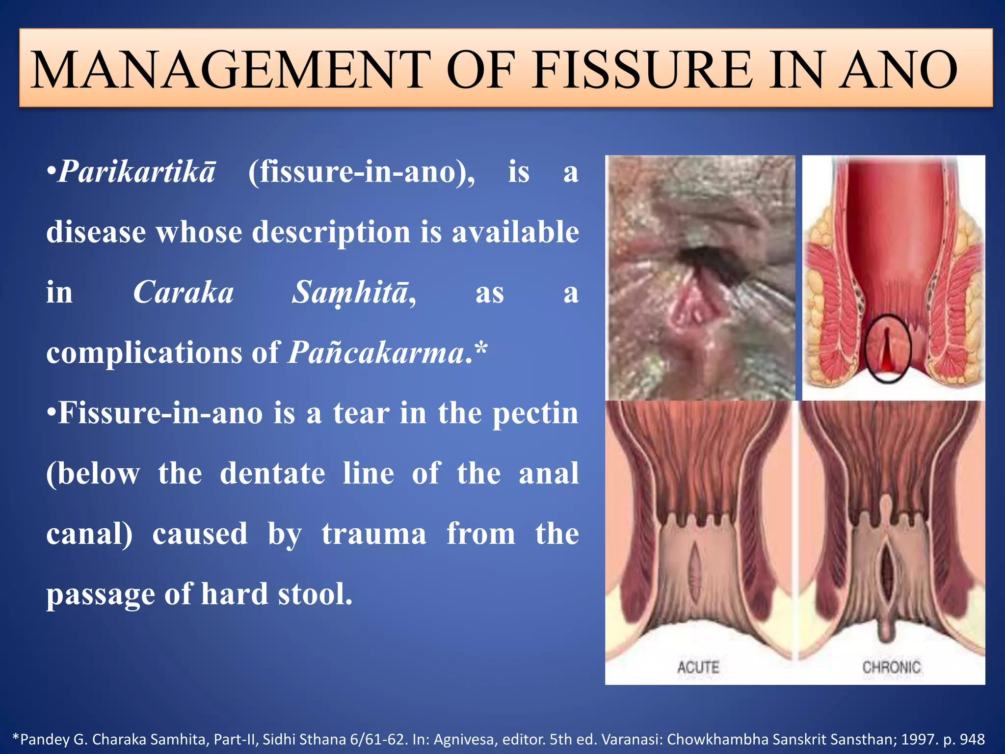 Role of anushastra in anorectal disease | PPTX