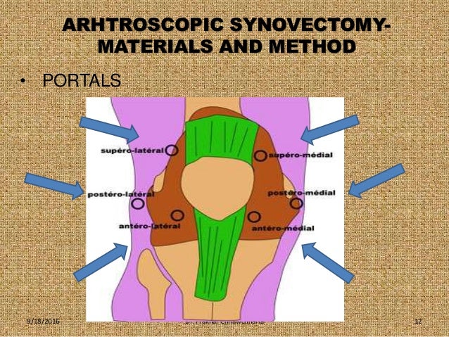 Role of arthroscopic synovectomy of knee joint in ra