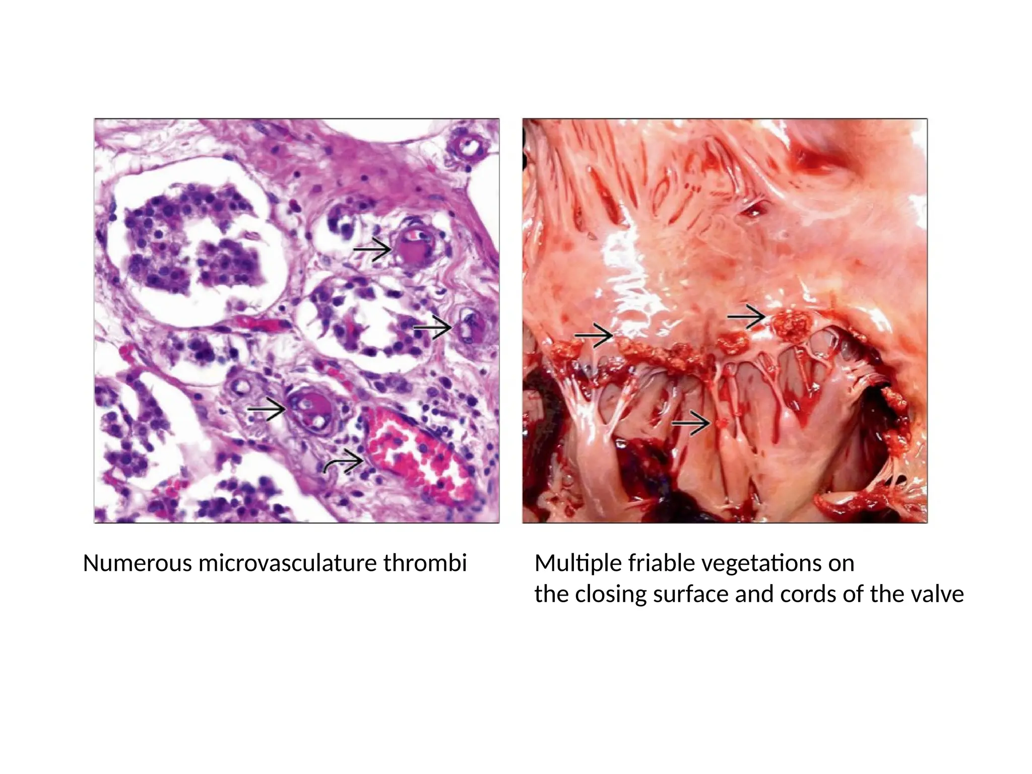 Role of autopsy in the diagnosis of sepsis and related syndrome.pptx