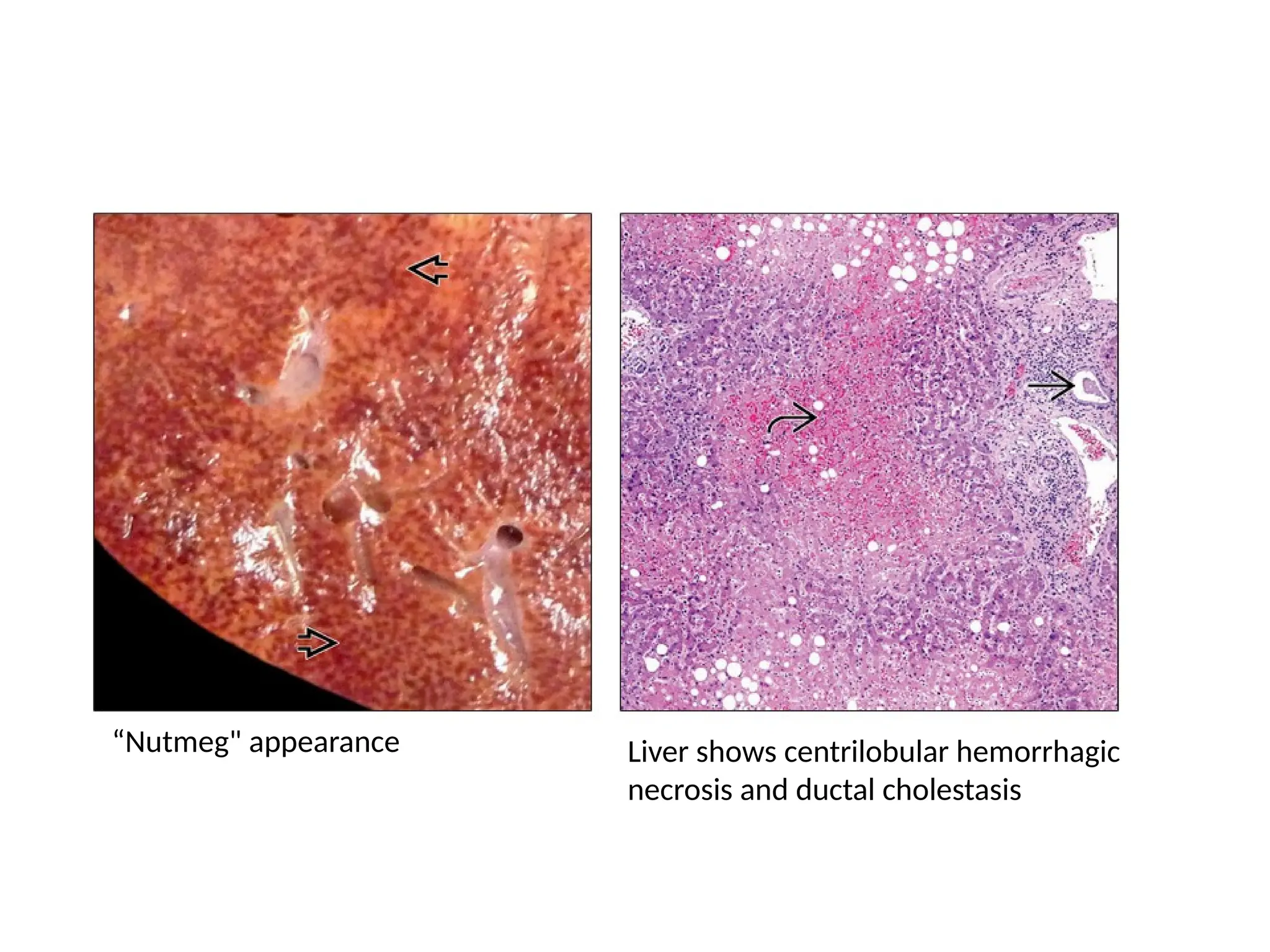 Role of autopsy in the diagnosis of sepsis and related syndrome.pptx