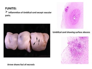 Role of autopsy in the diagnosis of sepsis and related syndrome.pptx
