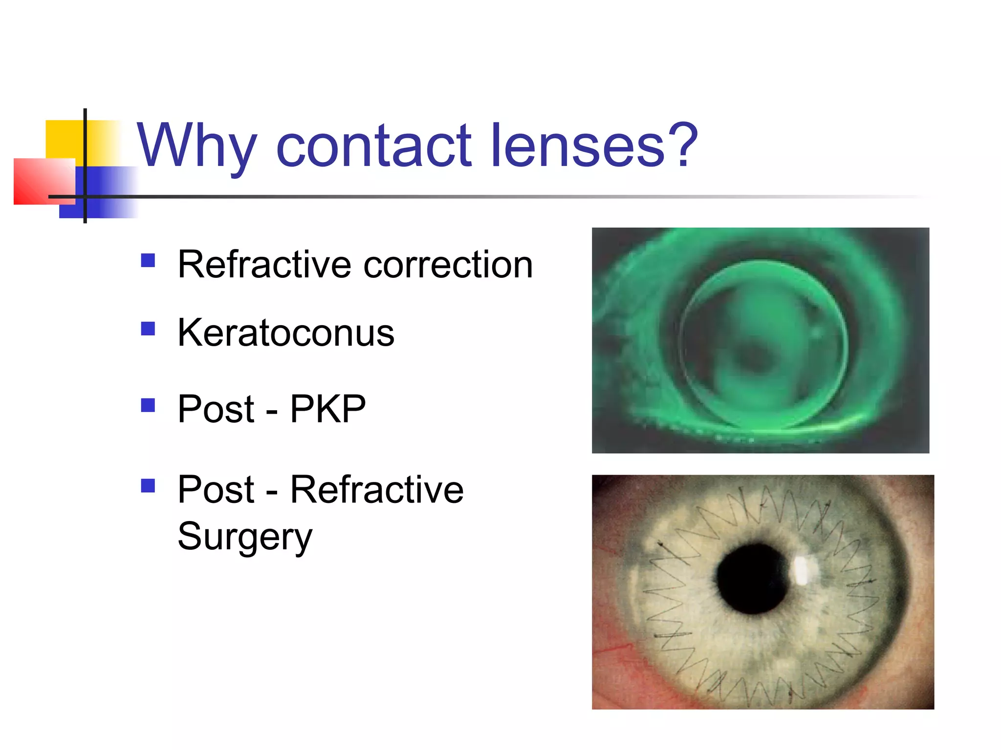 Role of bandage contact lens in corneal wound healing | PPT