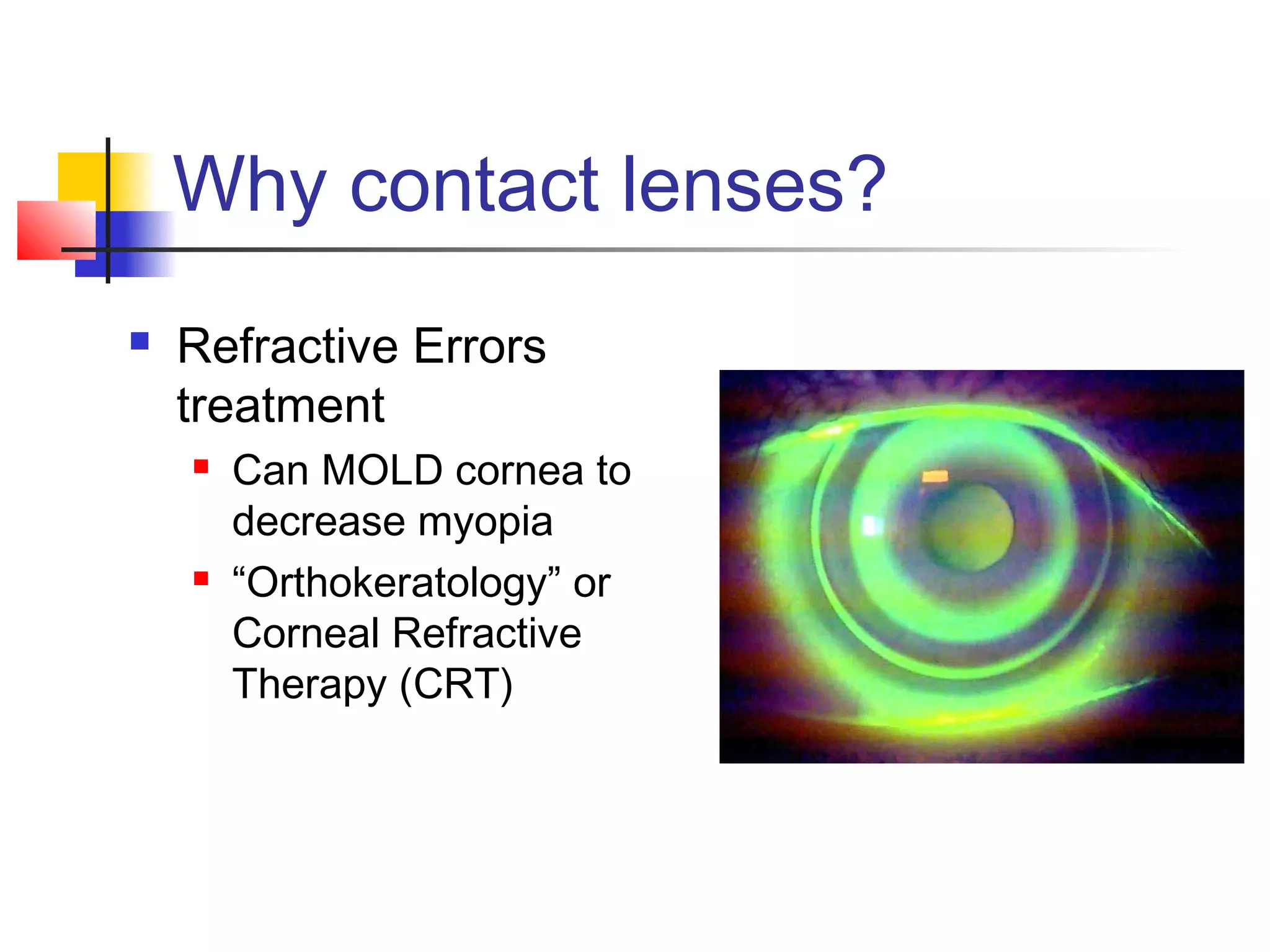 Role of bandage contact lens in corneal wound healing | PPT