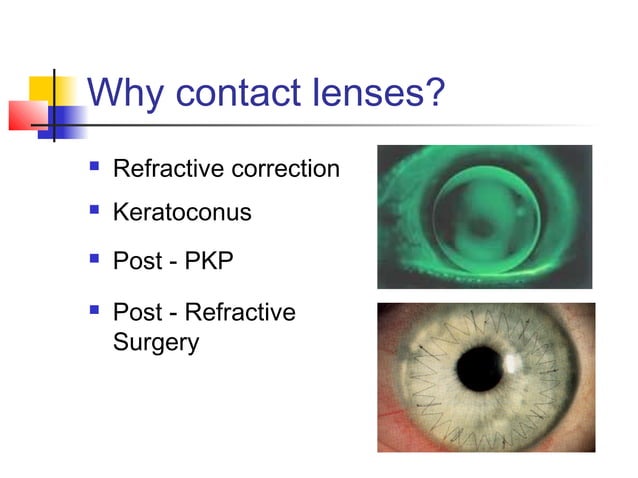 Role of bandage contact lens in corneal wound healing | PPT | Eye and ...