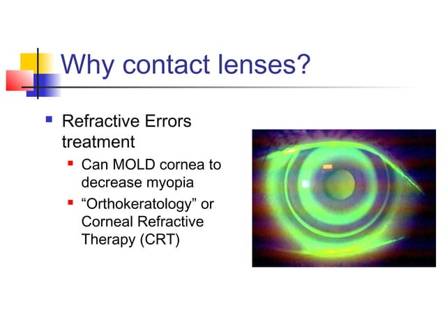 Role of bandage contact lens in corneal wound healing | PPT | Eye and ...