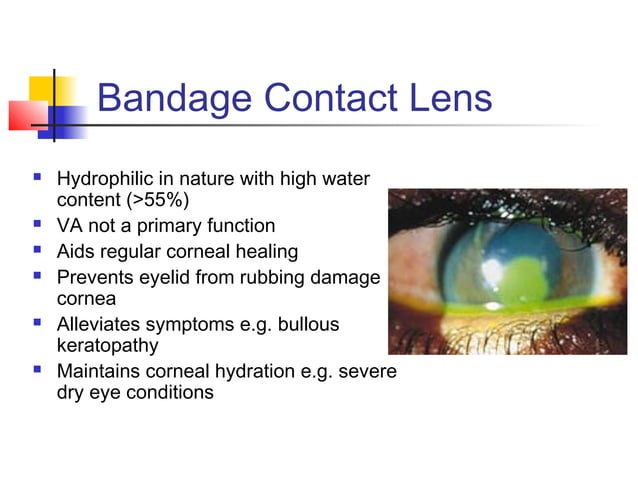 Role of bandage contact lens in corneal wound healing | PPT | Eye and ...