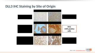 Role of BiTE (TARLATAMAB ) in extensive stage small cell lung cancer .pptx