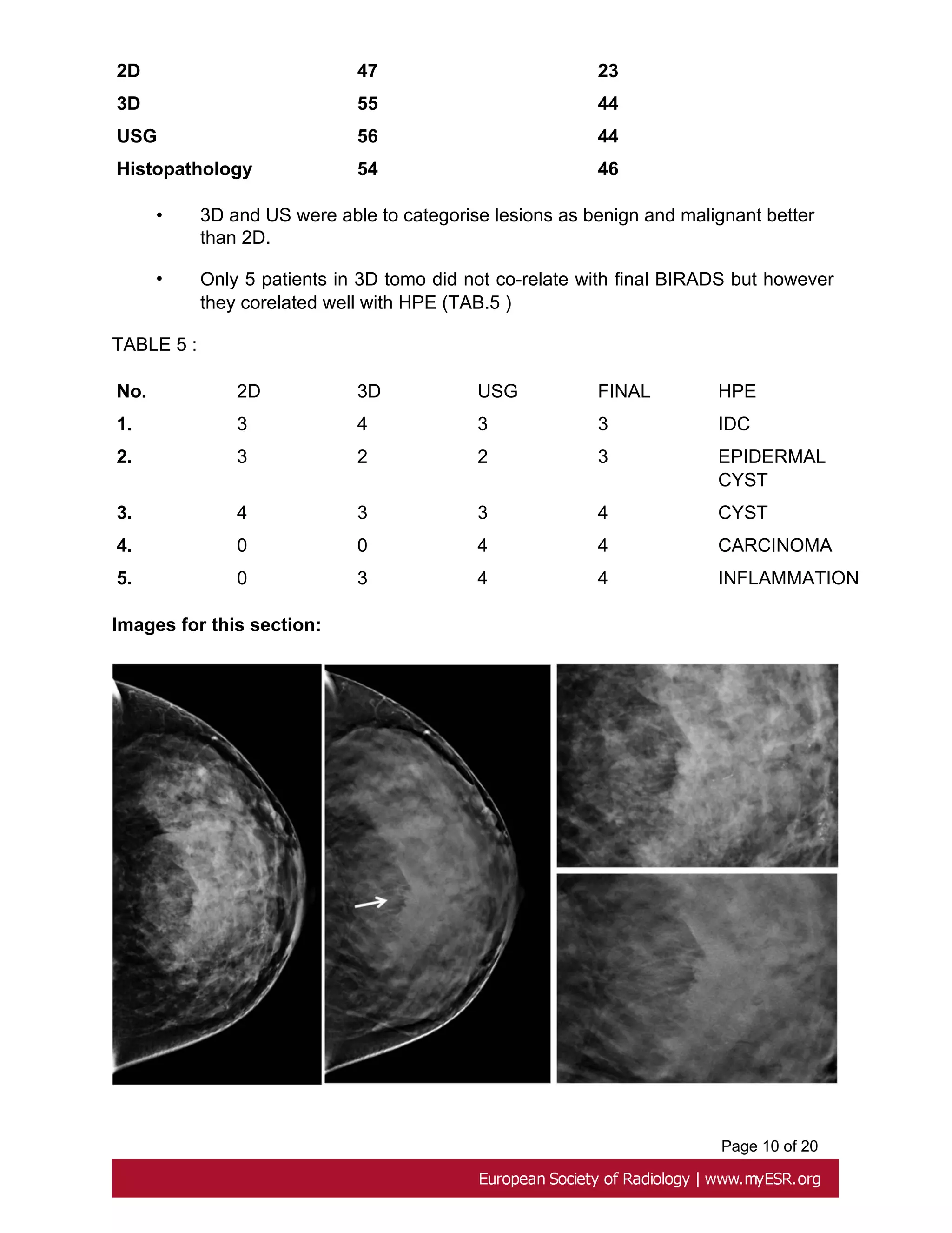 Role of Breast Tomosynthesis in the Morphological Analysis of Breast Lesions | PDF
