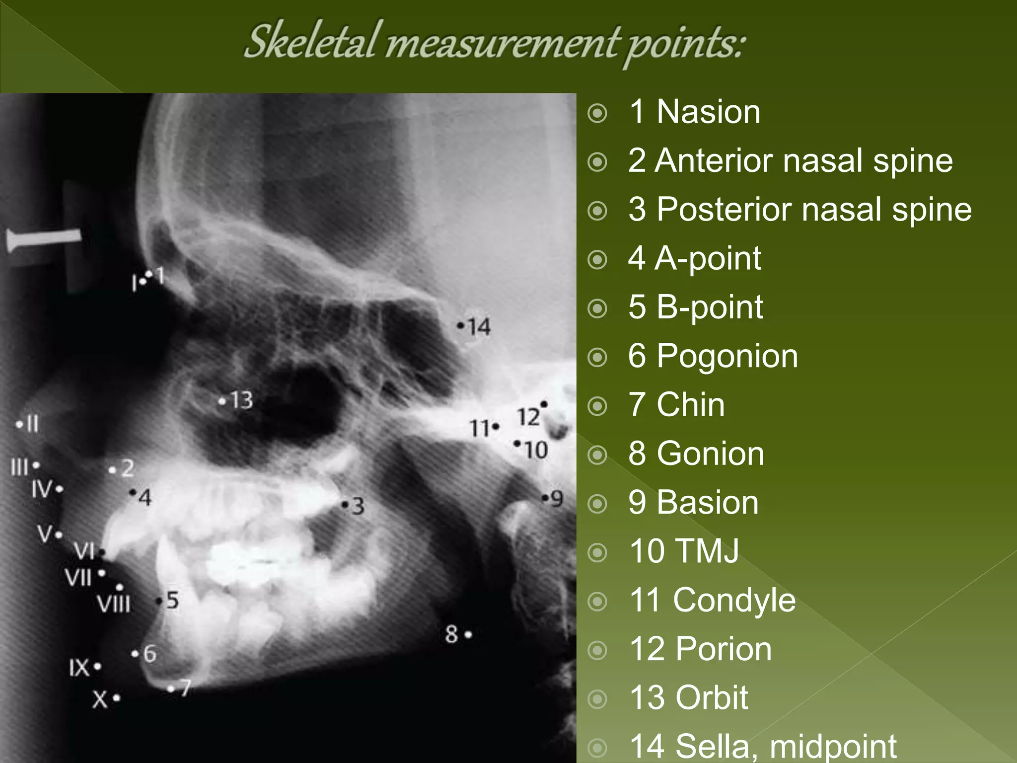 Role of cephalometry and panoramic radiographs in orthodontics. | PPTX