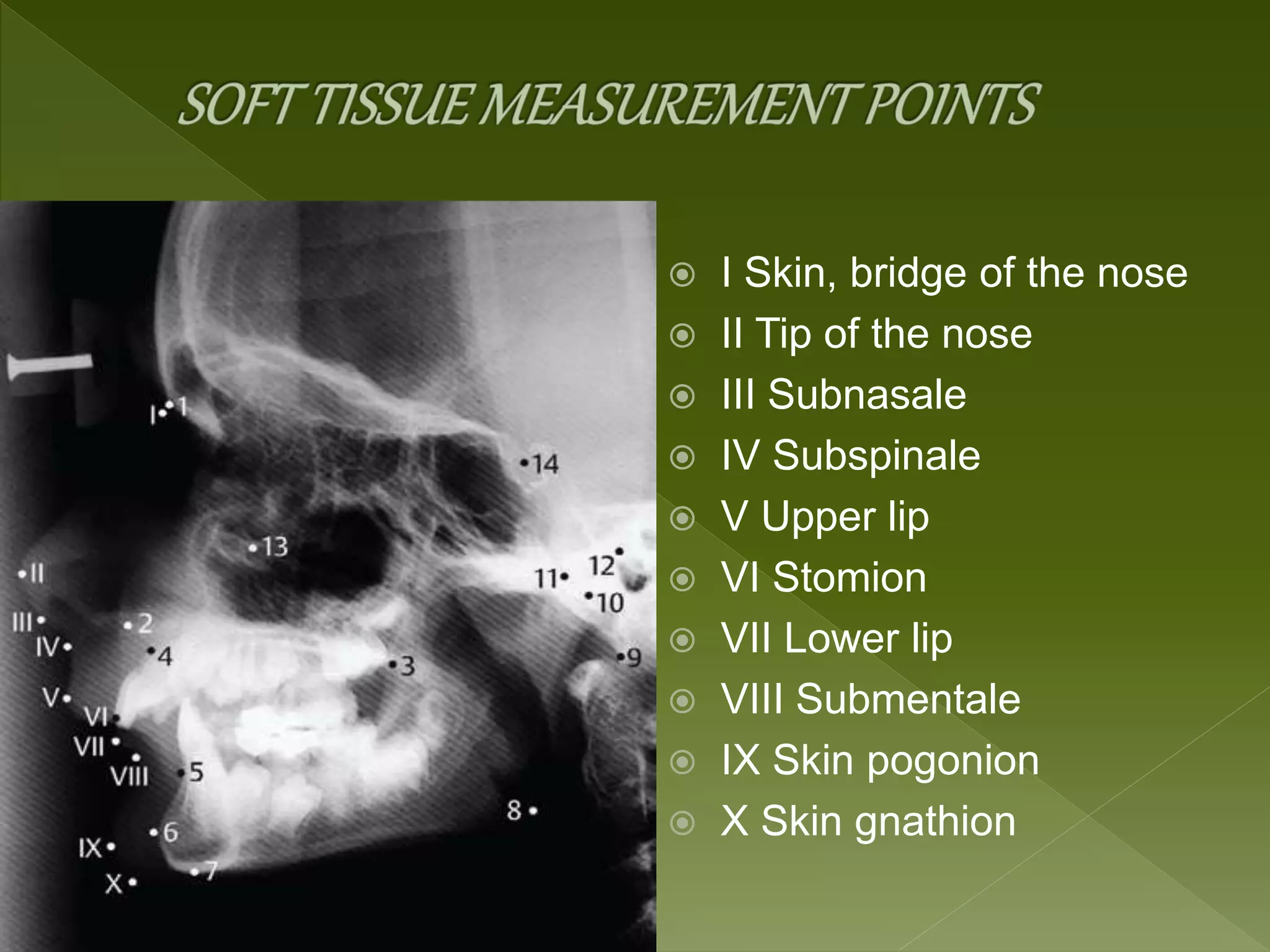 Role of cephalometry and panoramic radiographs in orthodontics. | PPTX ...