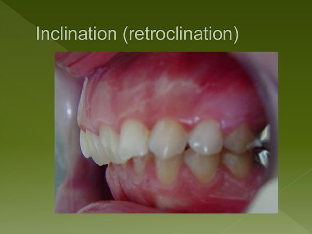 Role of cephalometry and panoramic radiographs in orthodontics. | PPTX ...