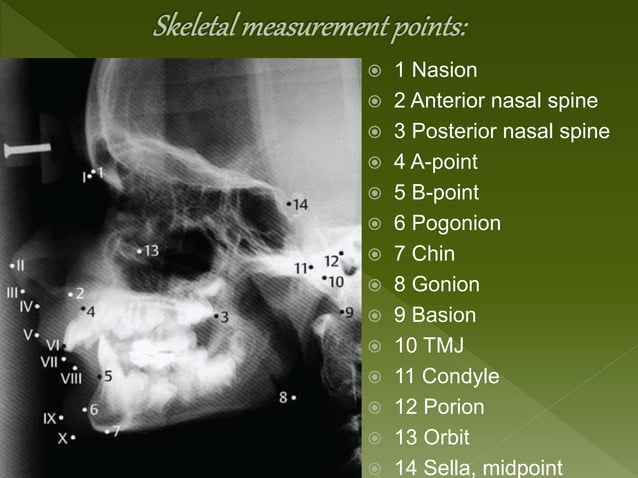 Role of cephalometry and panoramic radiographs in orthodontics. | PPTX ...