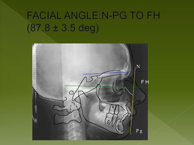 Role of cephalometry and panoramic radiographs in orthodontics. | PPTX ...
