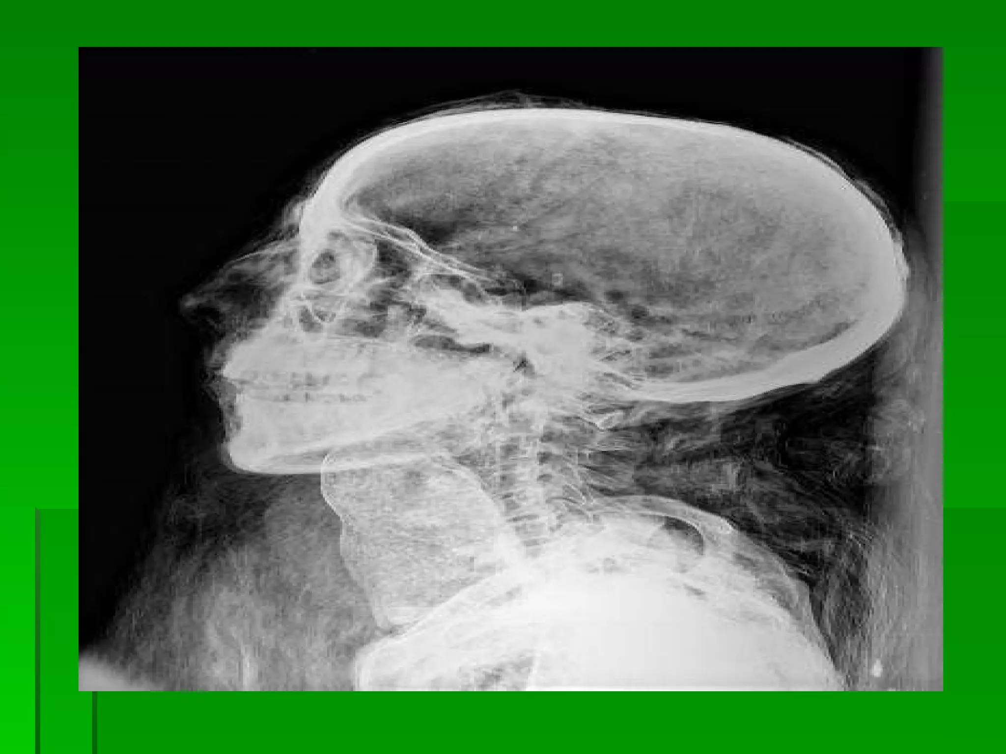 Perineal Hernia Animals | PPT