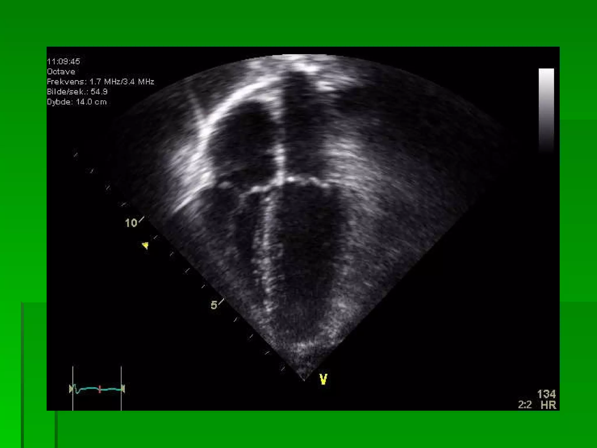 Perineal Hernia Animals | PPT