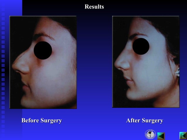 Role of computer simulation | PPT