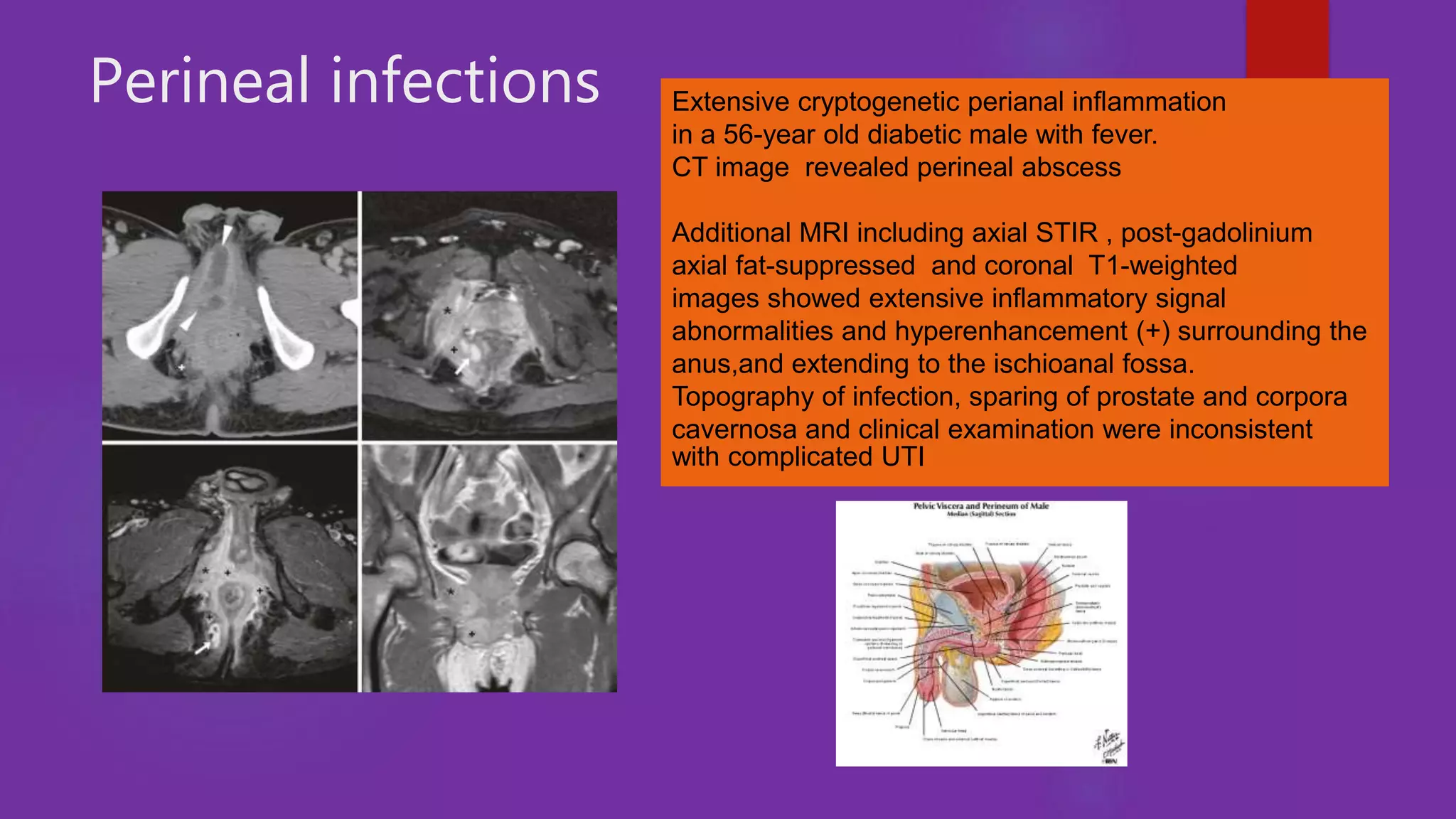 Role of imaging in urosepsis | PPTX