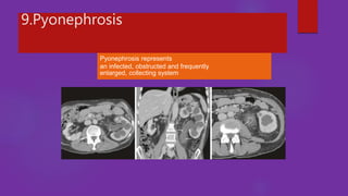 Role of imaging in urosepsis | PPTX