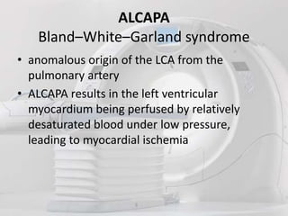 Role of ct angiography in diagnosis of coronary anomalies | PPT
