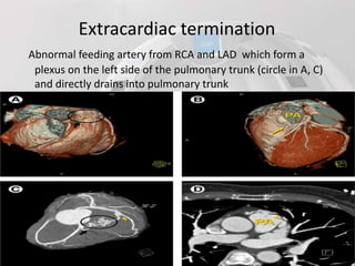 Role of ct angiography in diagnosis of coronary anomalies | PPT