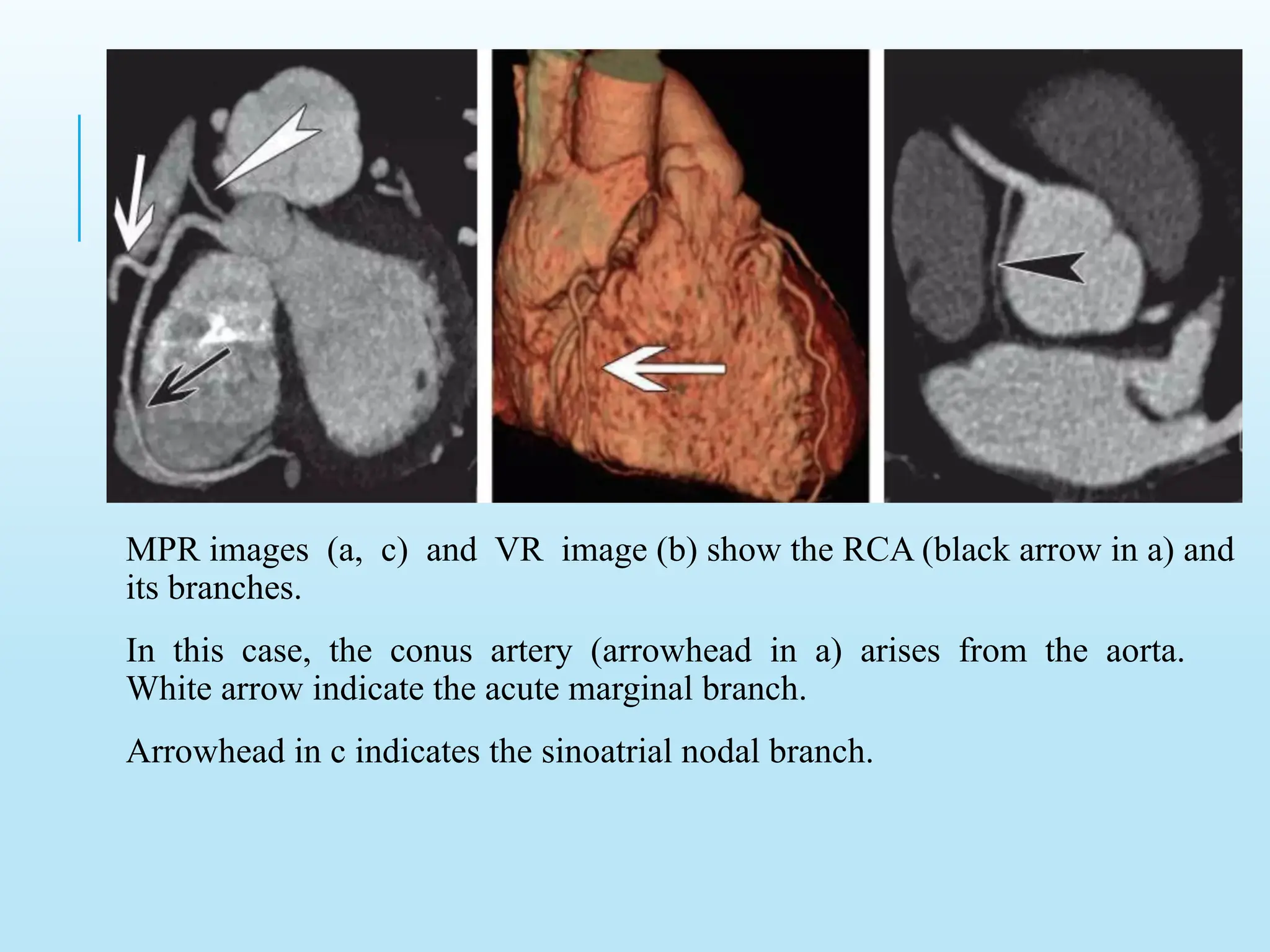 Role of CT Scan in Cardiac Imaging .pptx