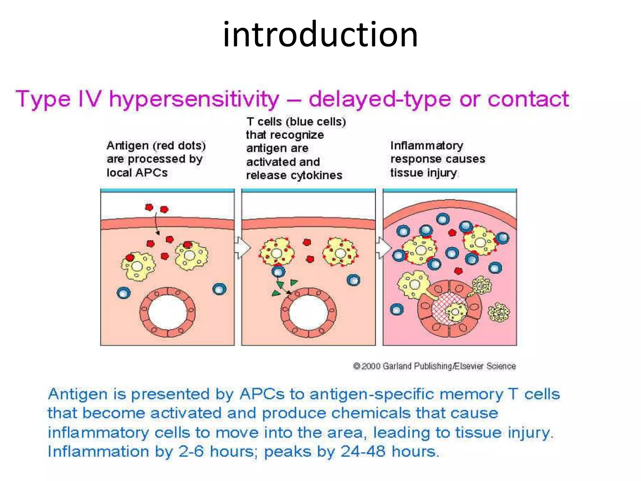 Role of cytokines in type iv hypersensitivity | PPTX